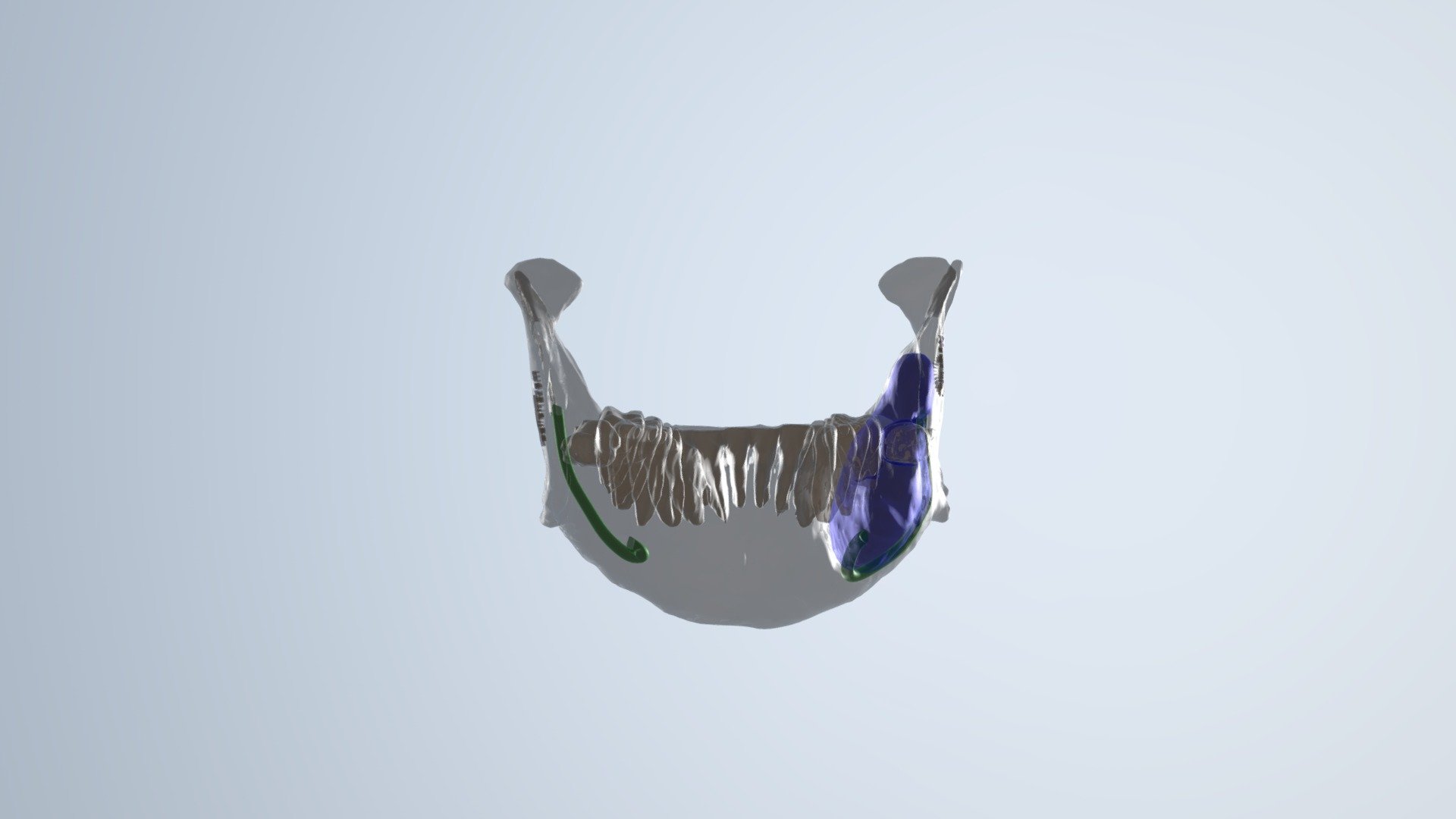 Mandible - 3D model by wake_imaging (@nwake) [0cc0b58] - Sketchfab