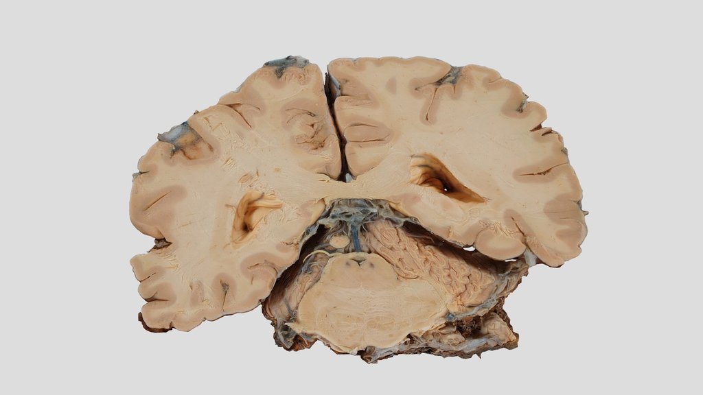 Neuroanatomy 3D - A 3D model collection by anatomydecoded - Sketchfab