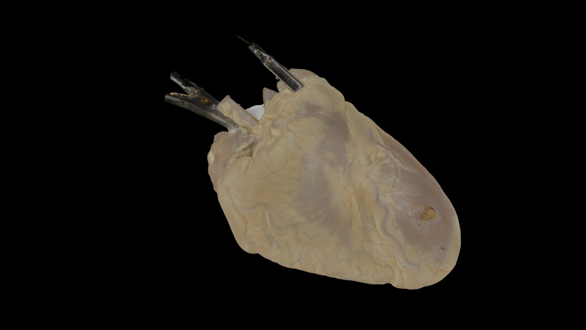 Human Heart Donation 49 - Download Free 3D model by VisibleHeartLabs ...