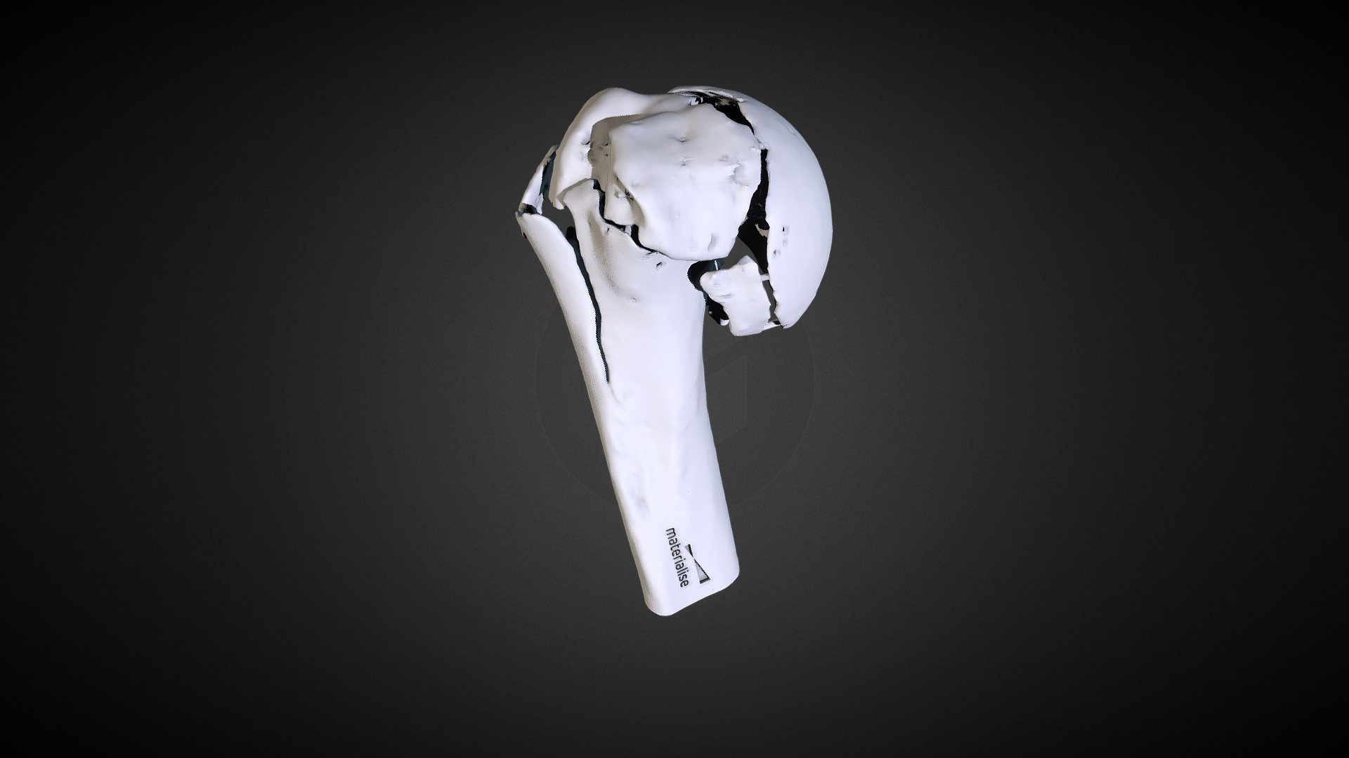 DKOU 2018 | Prox. Humerus fracture | S-181708-R - 3D model by World ...