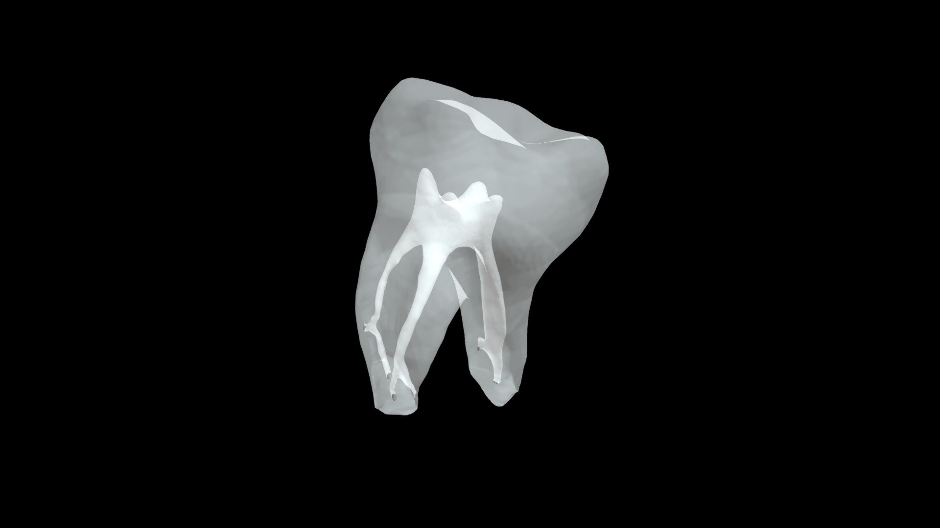 Tooth 30 - 3D model by biomed3d [0e199d2] - Sketchfab