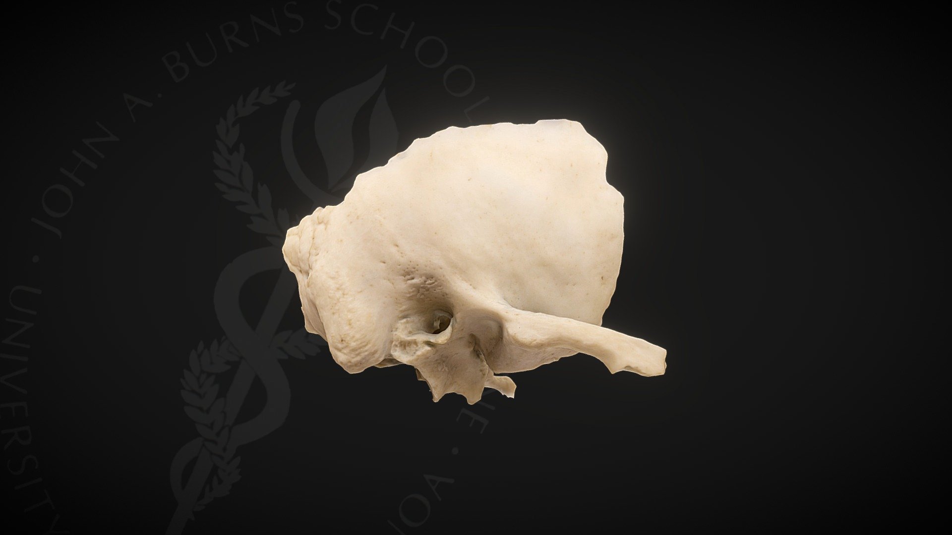 Internal Aspect of Temporal Bone - copy - 3D model by John A Burns ...