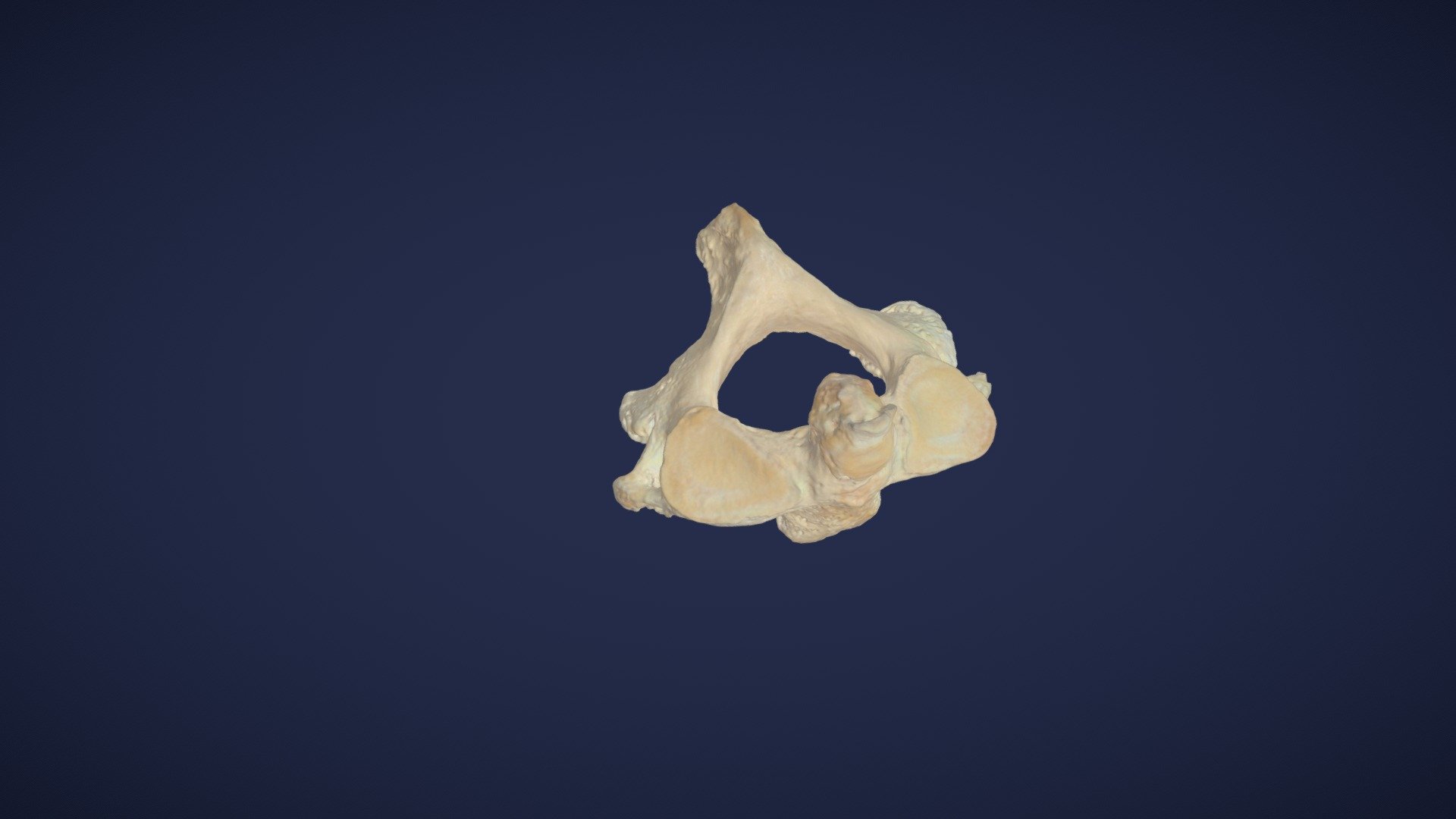 Axis (C2) - 2nd cervical vertebra - 3D model by Institute of Anatomy ...