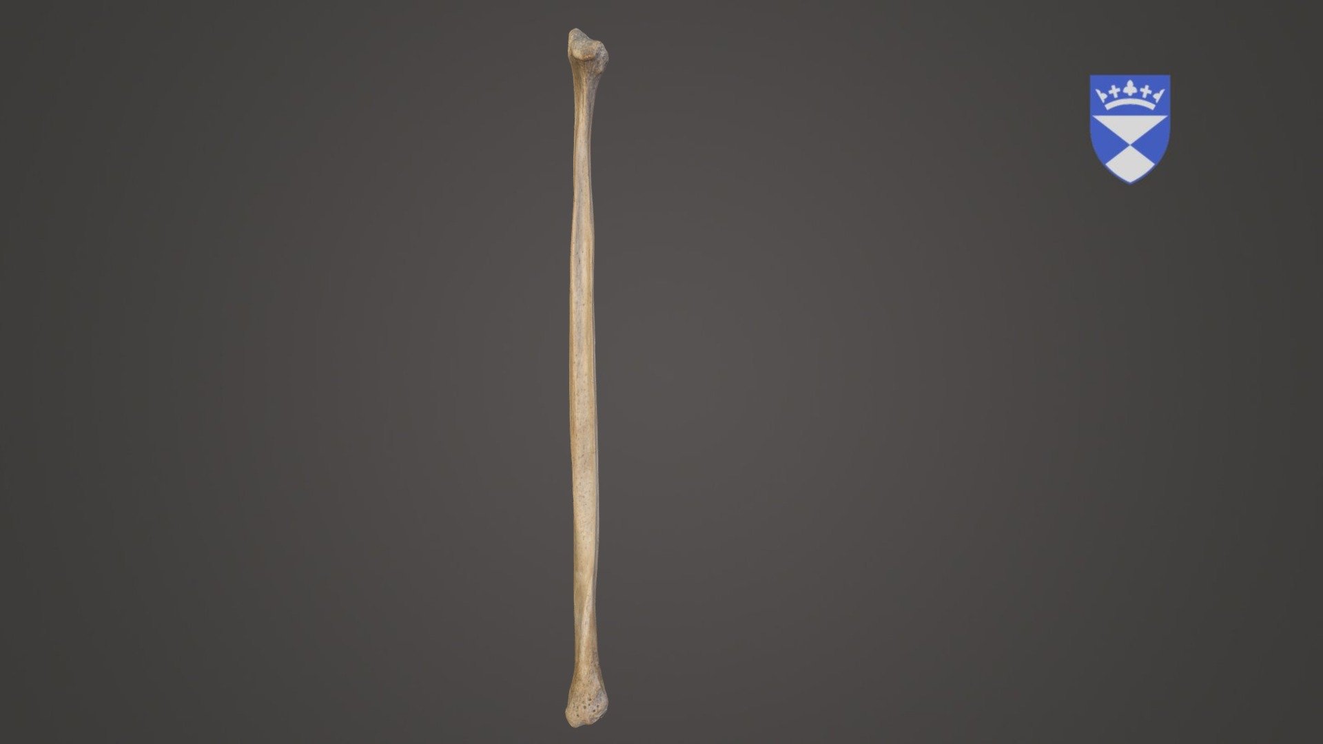 Fibula - 3D model by University of Dundee, CAHID (@anatomy_dundee ...
