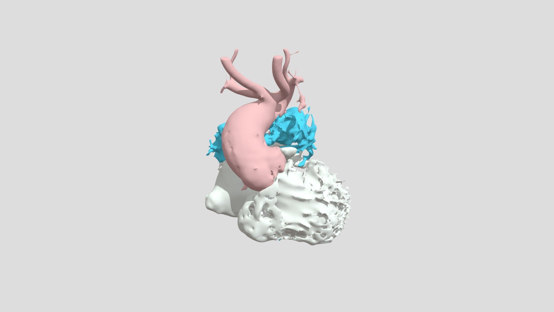 Heterotaxy, DORV (S0382) - 3D model by NCHS Cardiac Advanced Projects ...