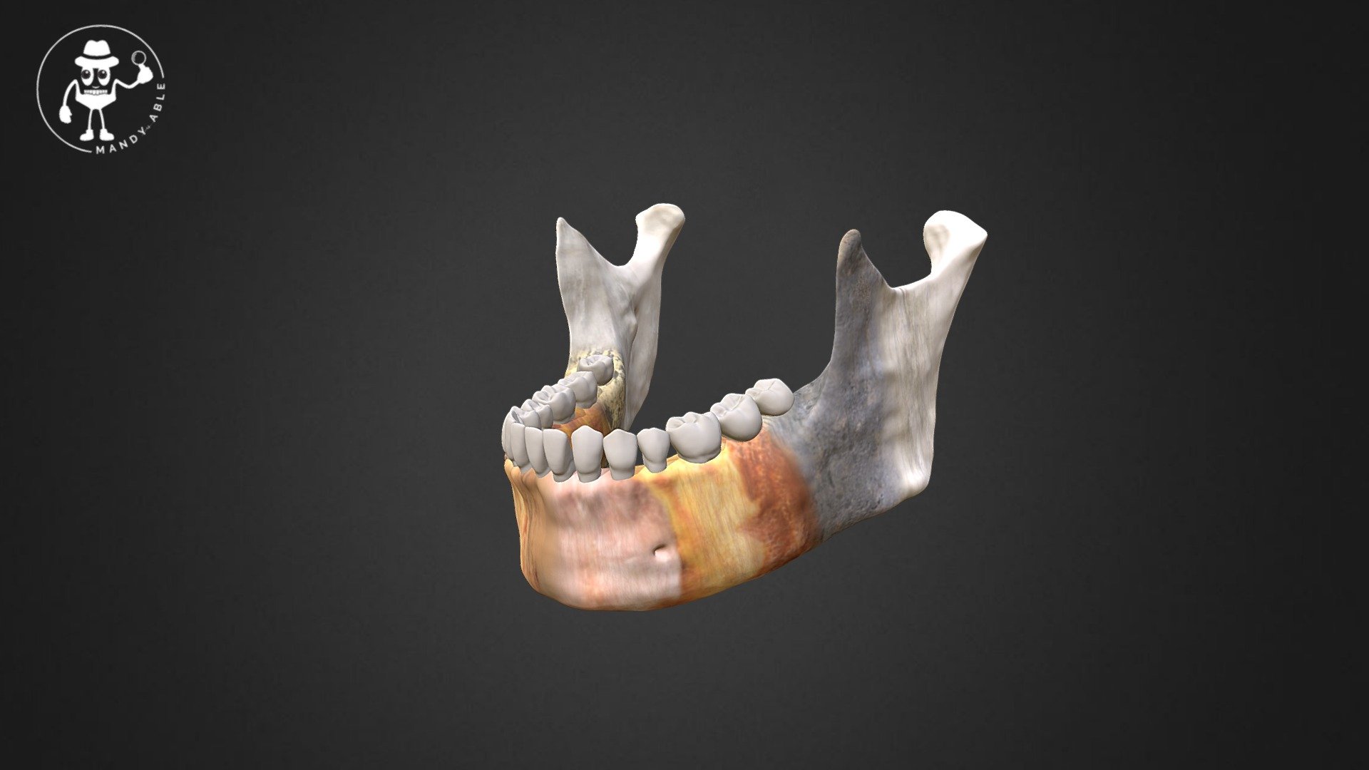 Thermal Trauma - 3D model by Doha Abualhija (@mandibleid) [0ec11c1 ...