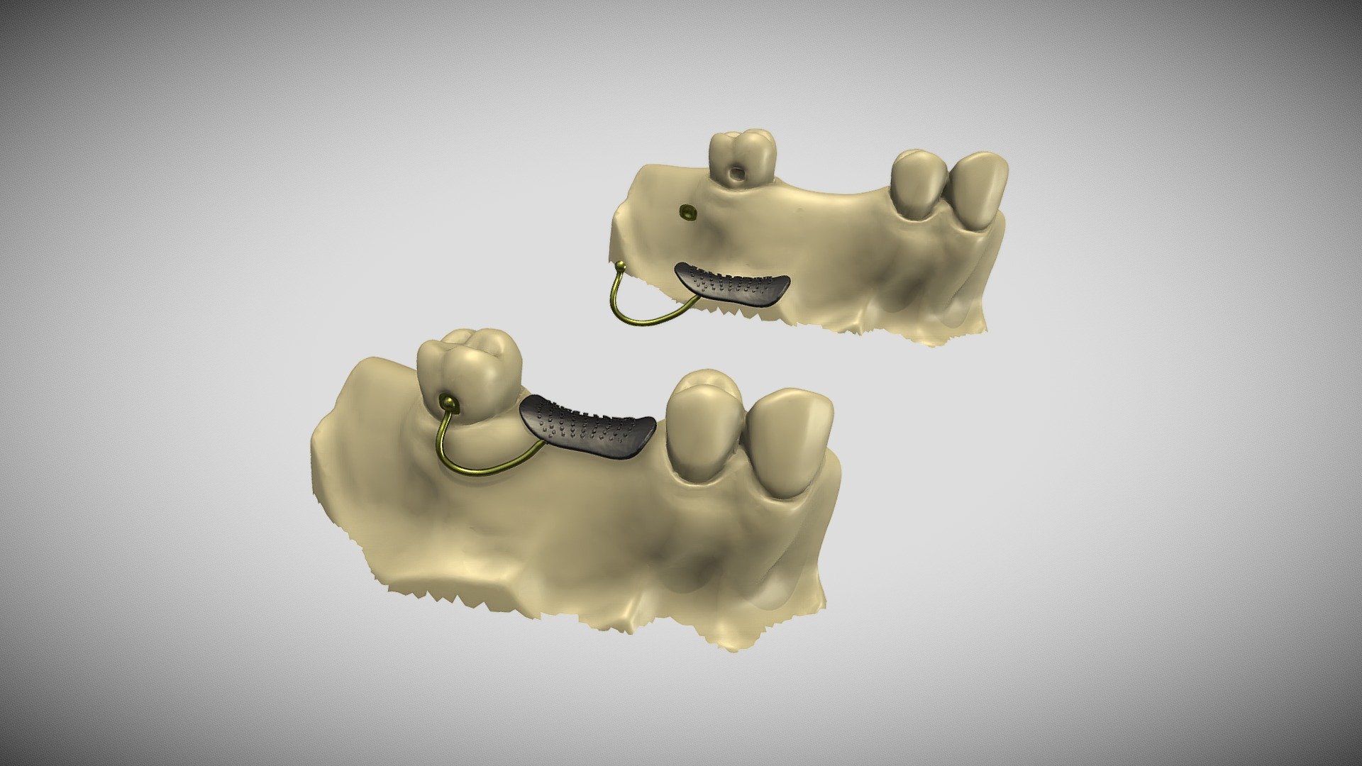 Ball And Socket Clasp With Gold Inlay - 3D model by Muhammad Nabeel ...