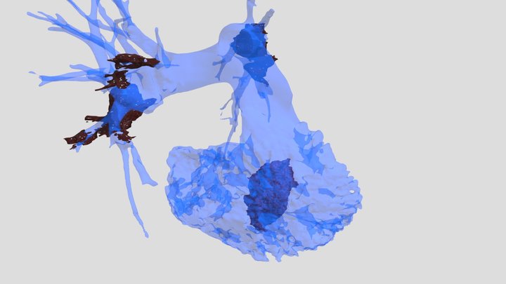 Thrombus 3D models - Sketchfab