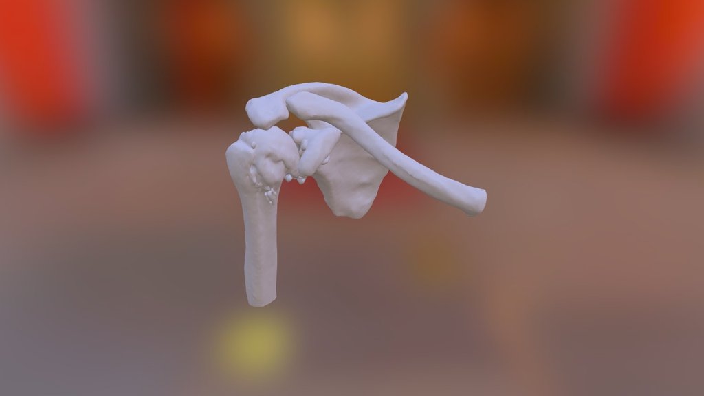 Shoulder Arthritis - sku379 - 3D model by orto3d [108ee66] - Sketchfab