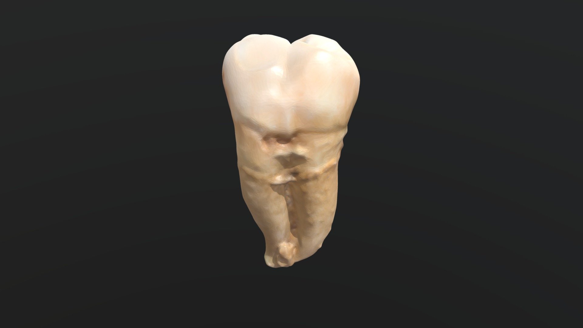 Segundo molar mandibular izquierdo (3.7) - 3D model by GIDPTD [10926e4 ...