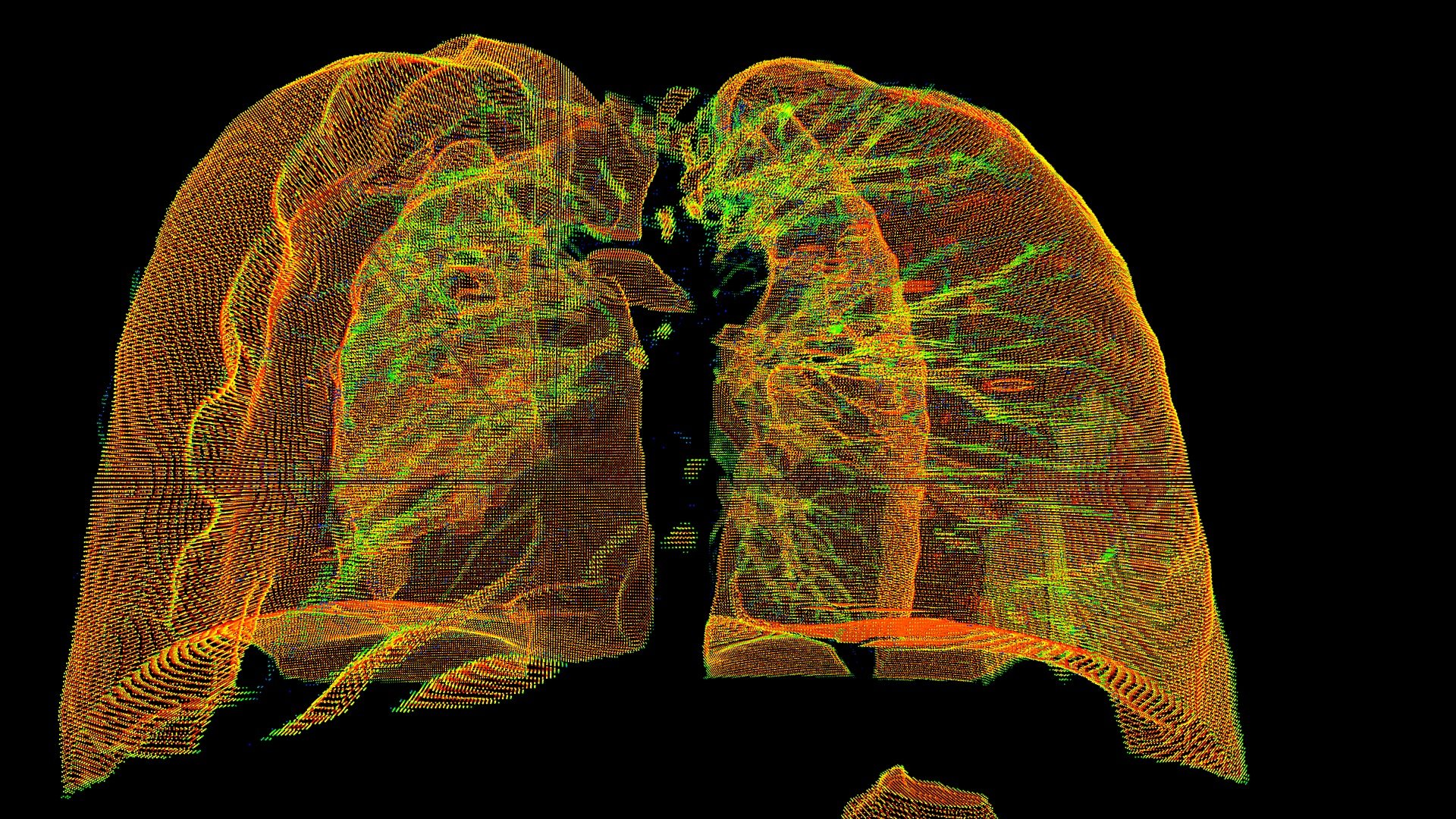 CT scan lung - Download Free 3D model by Mesheritage [10943d7] - Sketchfab