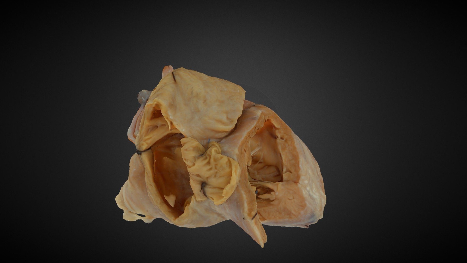 29 - 3D model by CHOP Cardiac Specimens (@cardiacspecimens) [10c3da3 ...