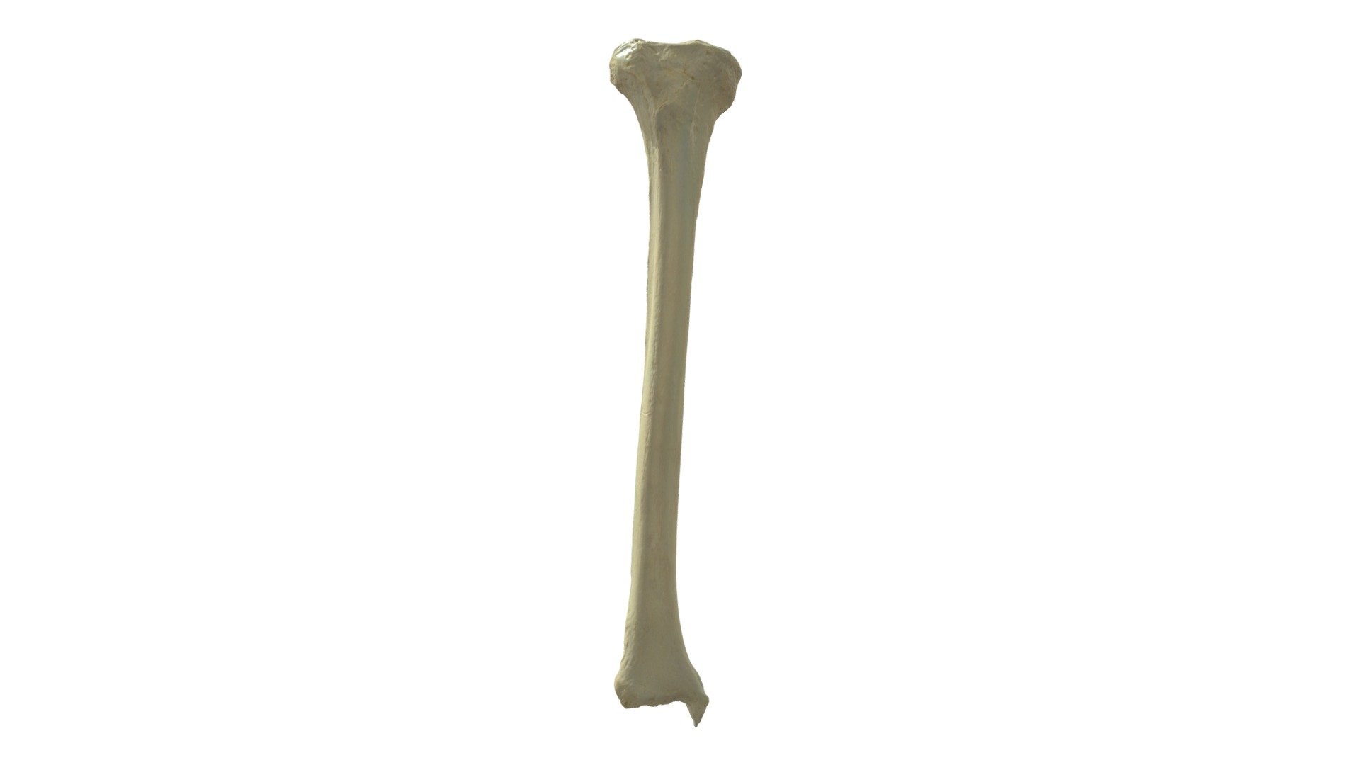 Tibia R - Distale epifyse - annotaties - 3D model by Universiteit ...