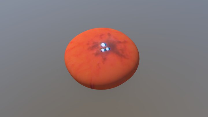 Cataract 3D models - Sketchfab
