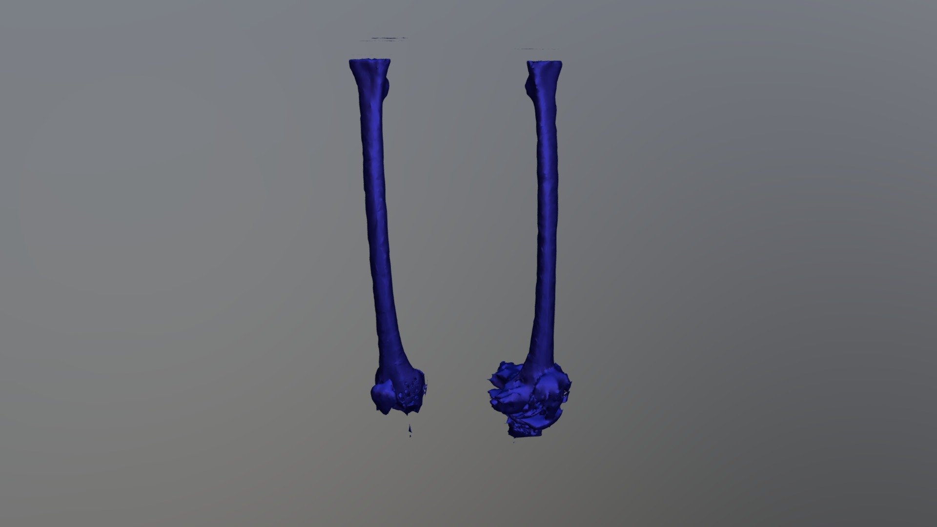 Femur Segmentation Download Free 3d Model By Dominic3737 [114ca14] Sketchfab