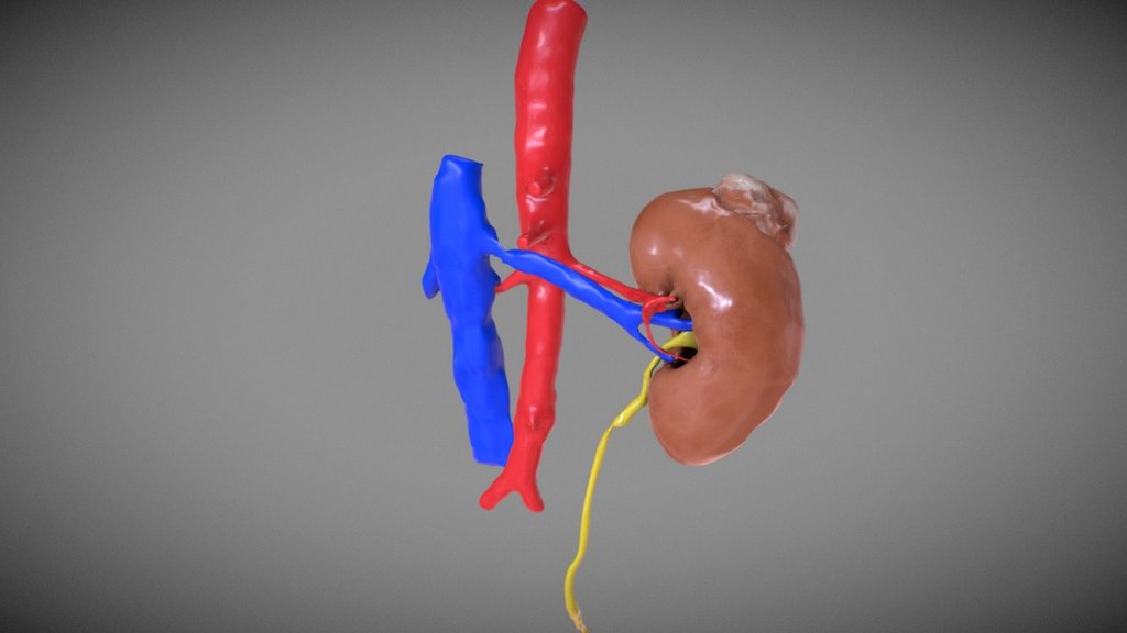 03_Kidney_CT - 3D model by URO (@SIULIVE) [1159706] - Sketchfab