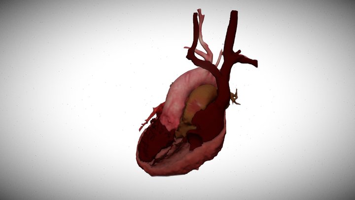 3DCardio - Sketchfab