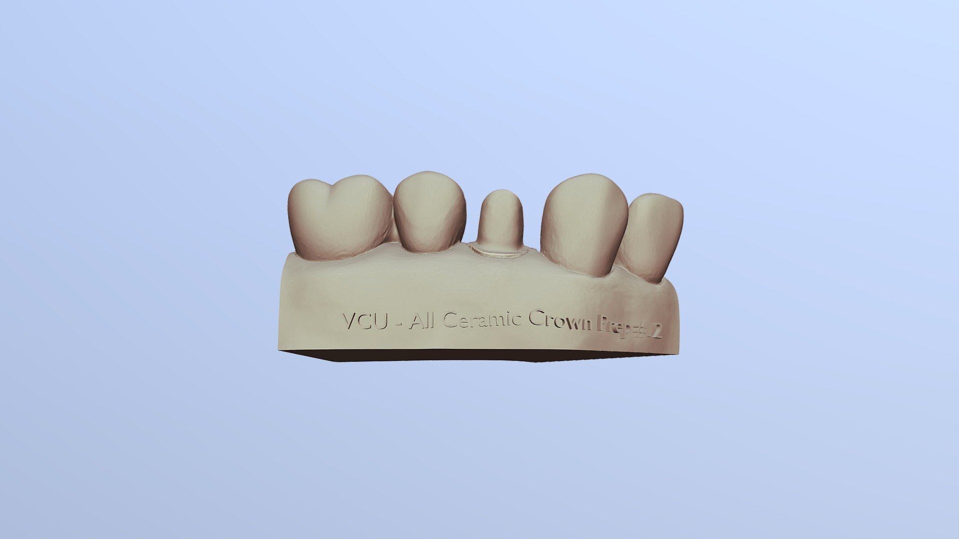 All Ceramic Crown Preparation Tooth #12 - 3D model by ramiammoun ...