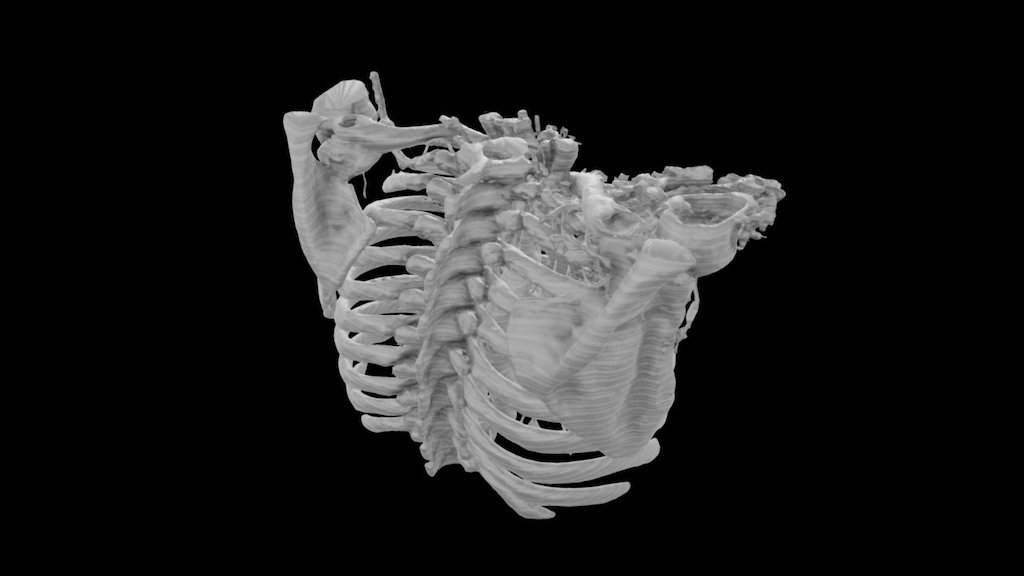 Chest - 3D model by Wellness Computational (@wellnesscomputational ...