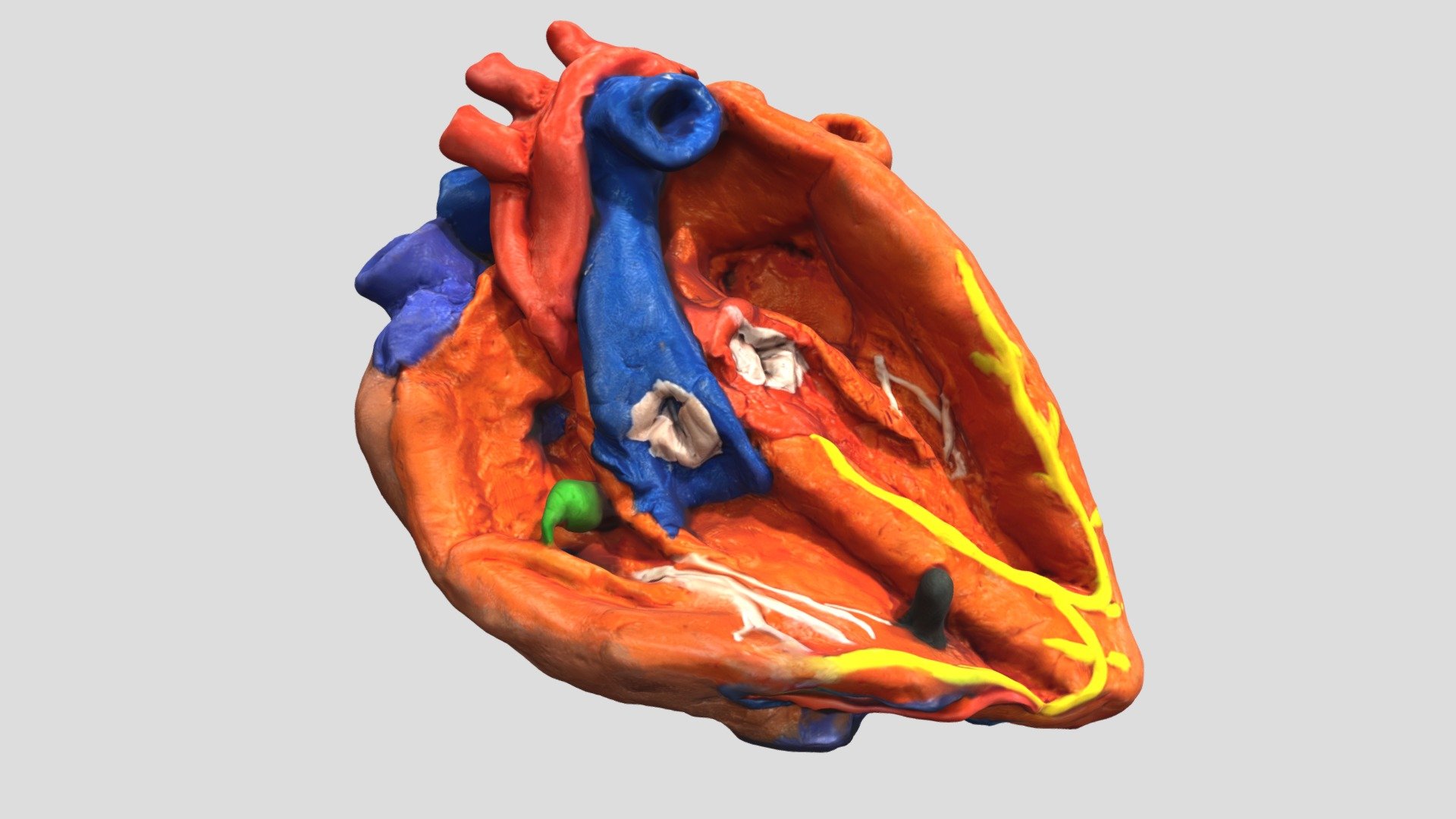 Pacemaker Model - 3D model by theahubbard [11d6974] - Sketchfab