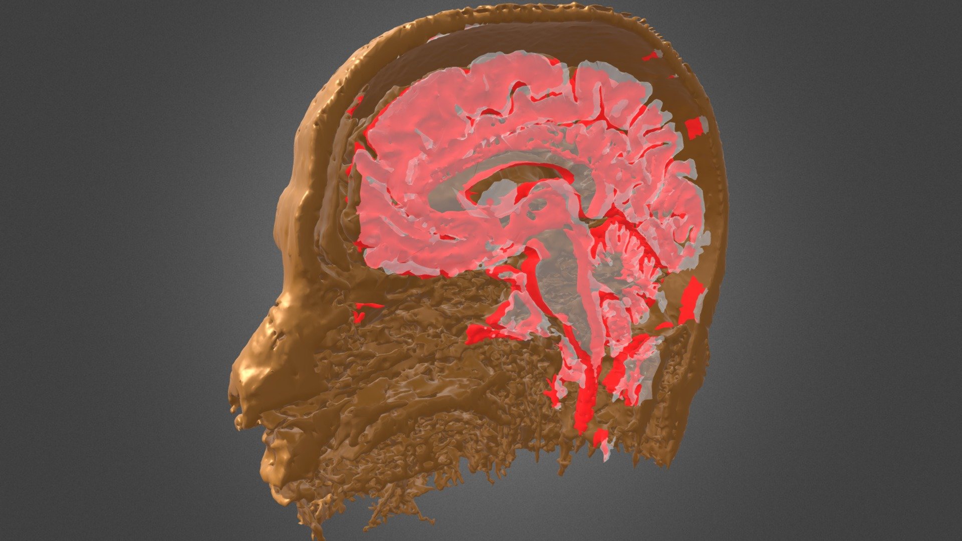 CT BRAIN - 3D model by Interactive 3D Data (@proteinsimulation ...