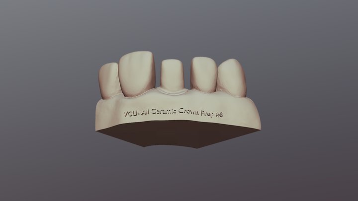 Maxillary 3D models - Sketchfab
