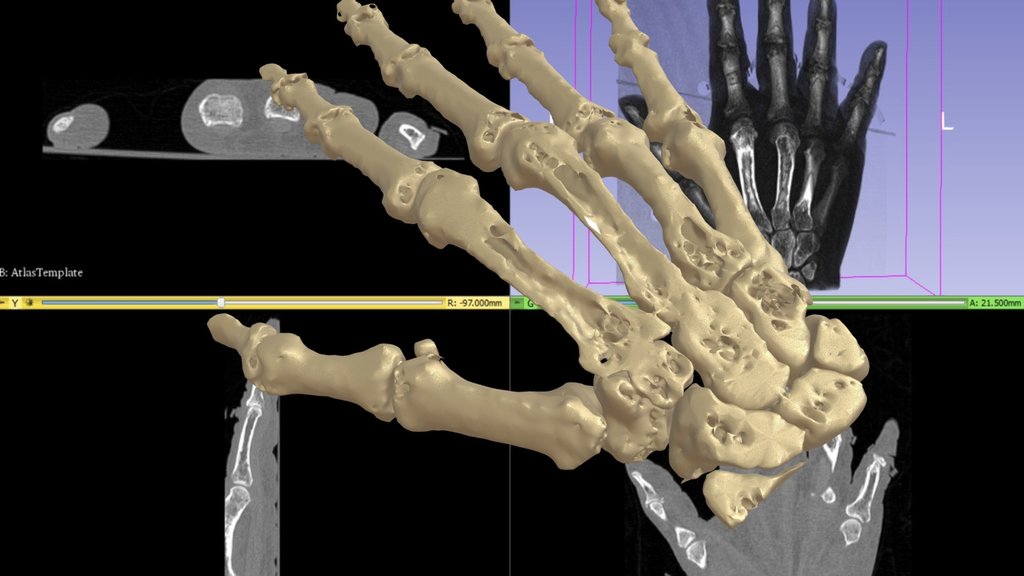 handreference - A 3D model collection by aviaadonis - Sketchfab