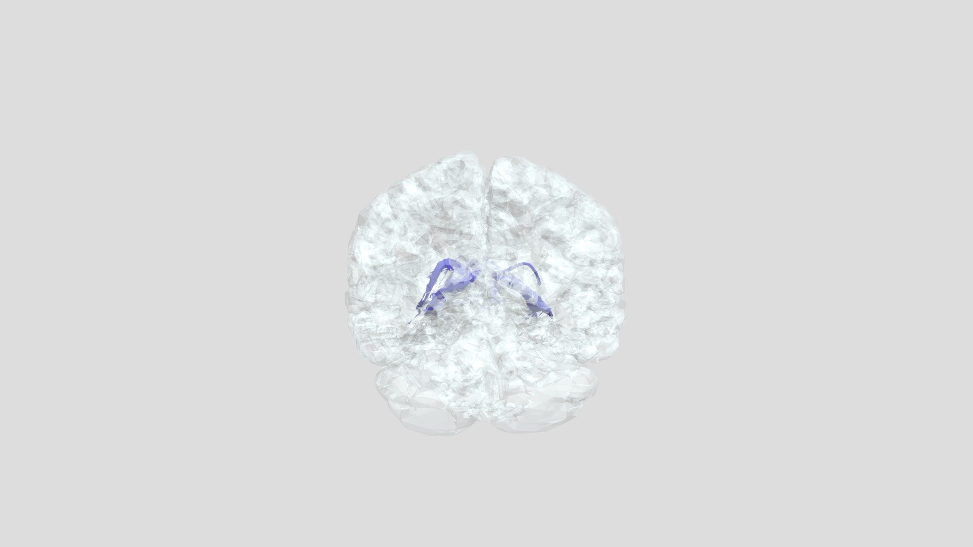 right and left fornix - 3D model by 3D Neurosurgery (@3dneurosurgery ...