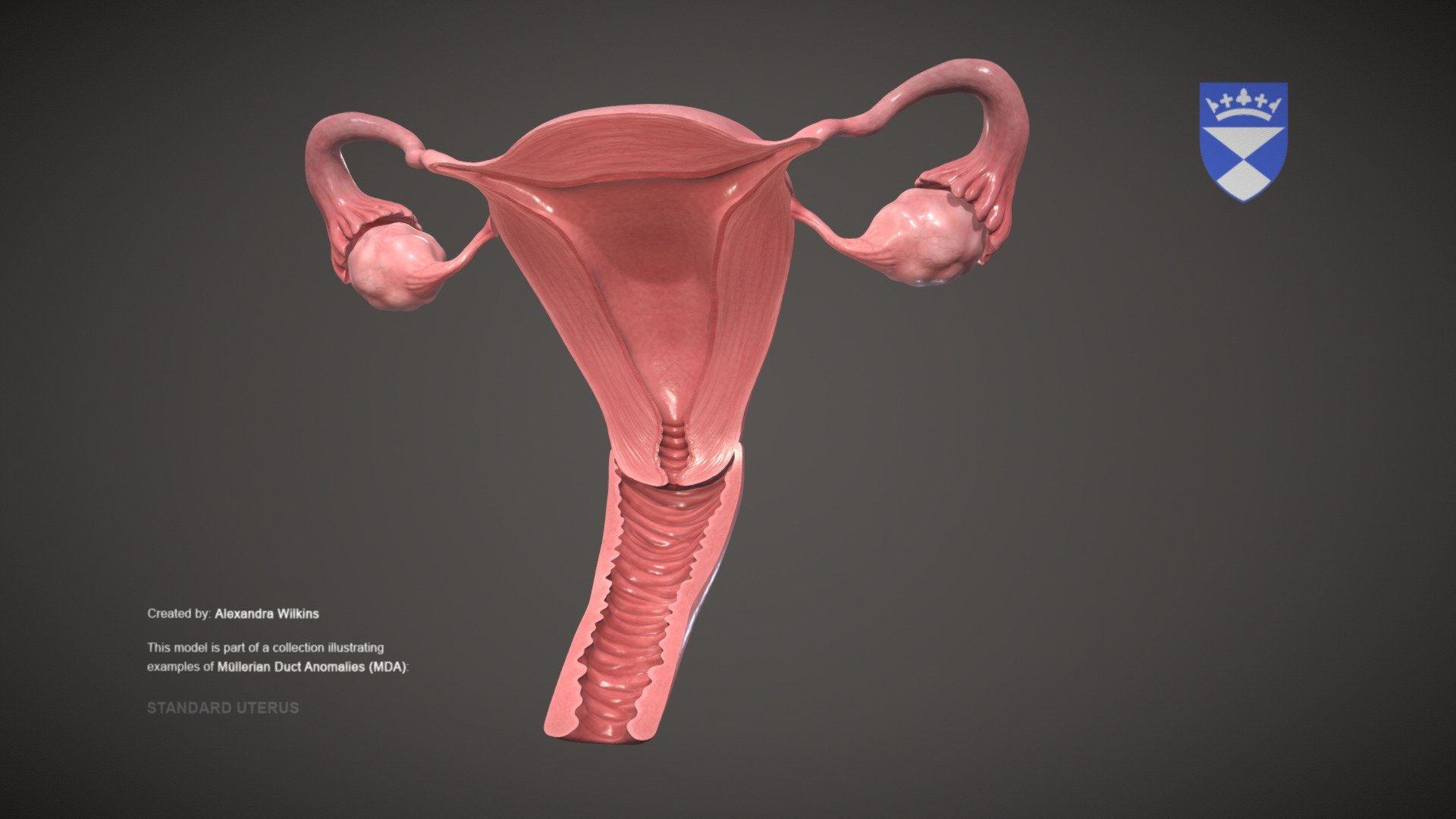 Standard Uterus Anatomy - Cross Section - 3D model by University of ...
