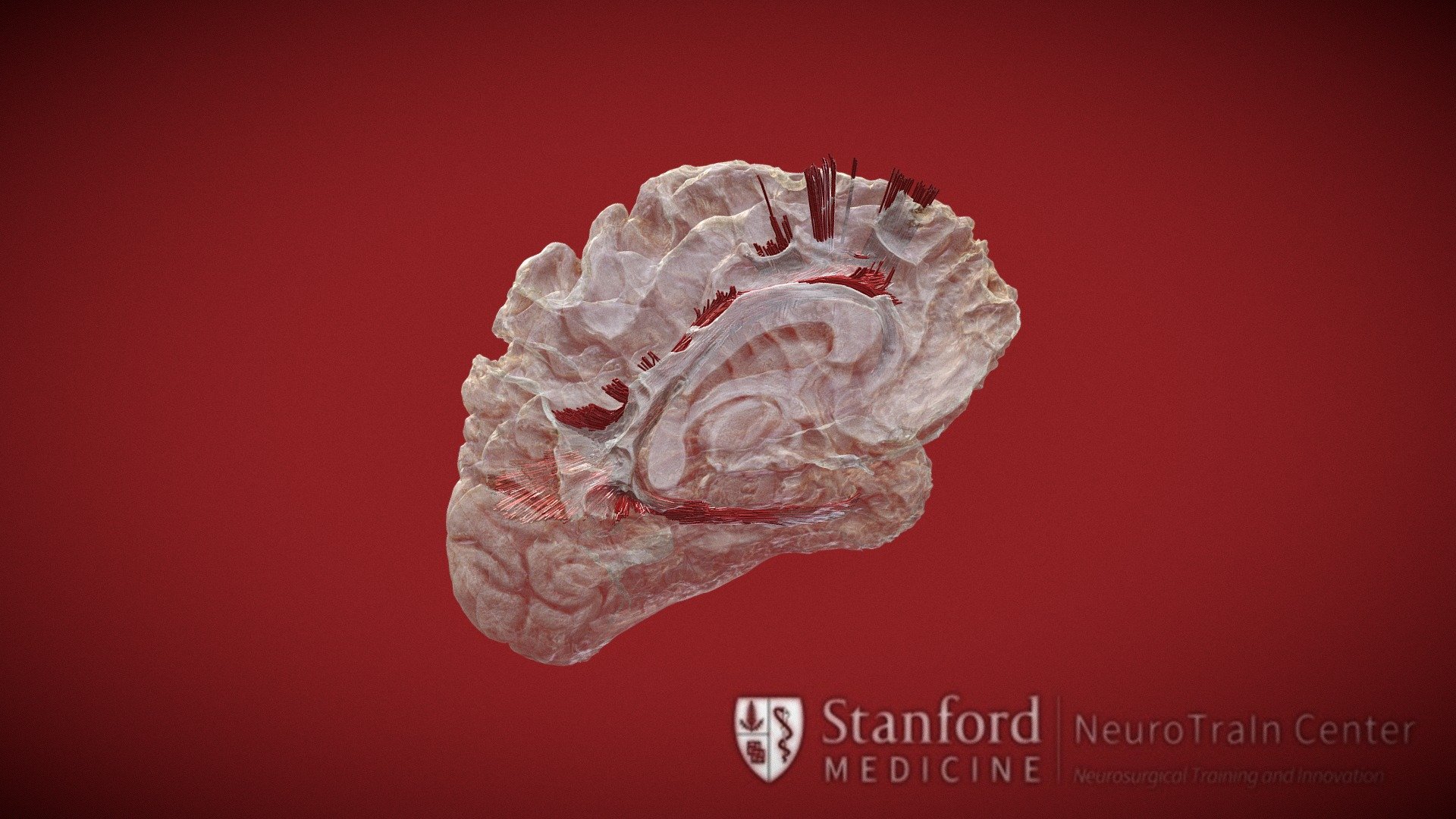 Cingulum - 3D model by vv (@verav) [1480e1a] - Sketchfab