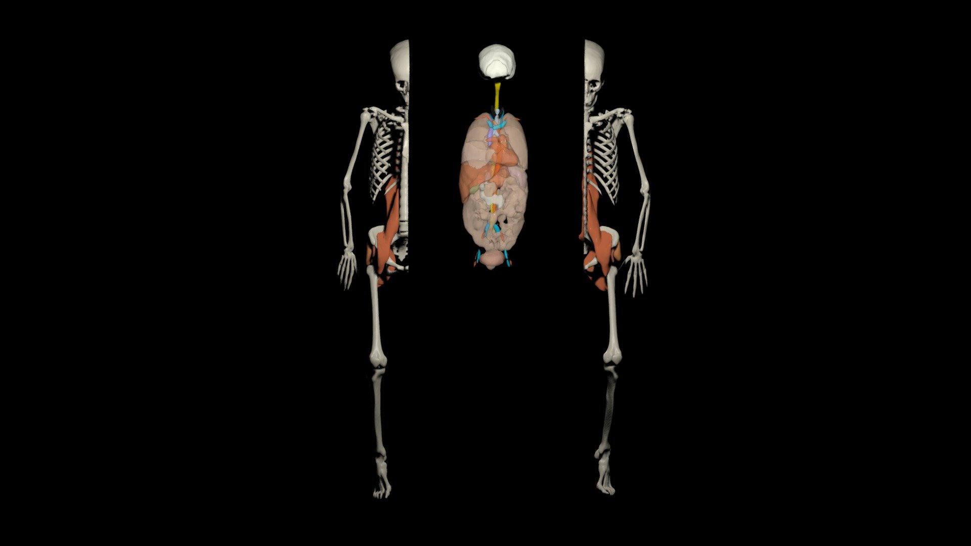 Full Body CT - 3D model by Terrie Simmons-Ehrhardt (@terrielsimmons ...