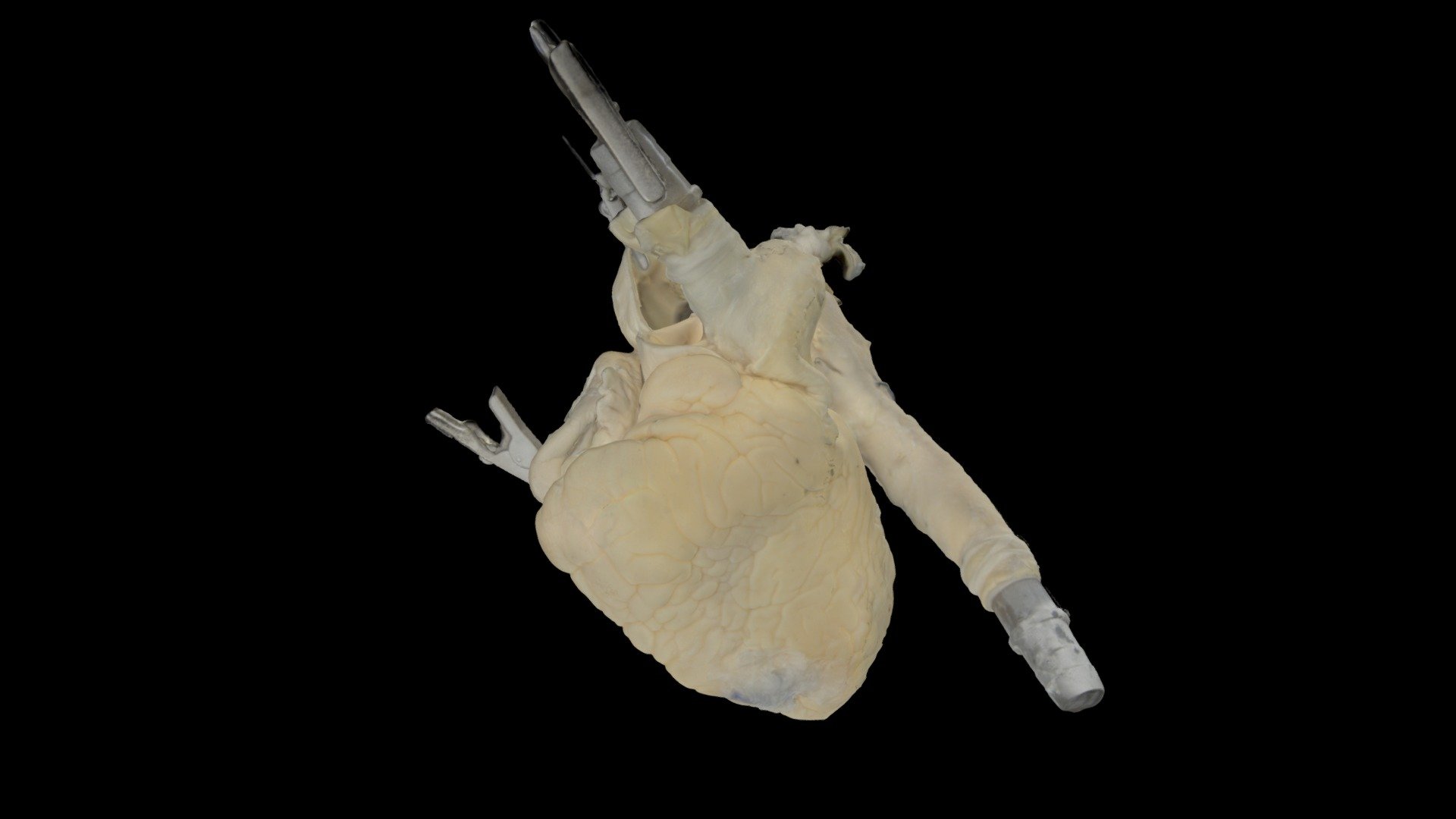 Perfusion Fixed Human Heart Dissected Aorta - Download Free 3D model by ...