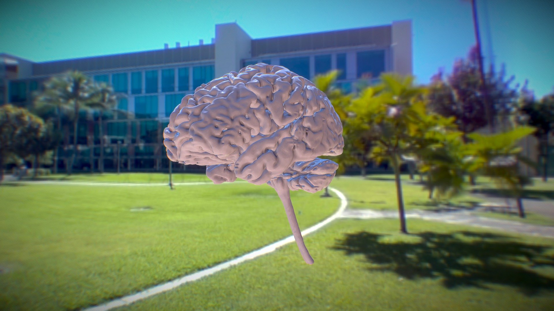 Segmentation - 3D model by John A Burns School of Medicine (@jabsom ...