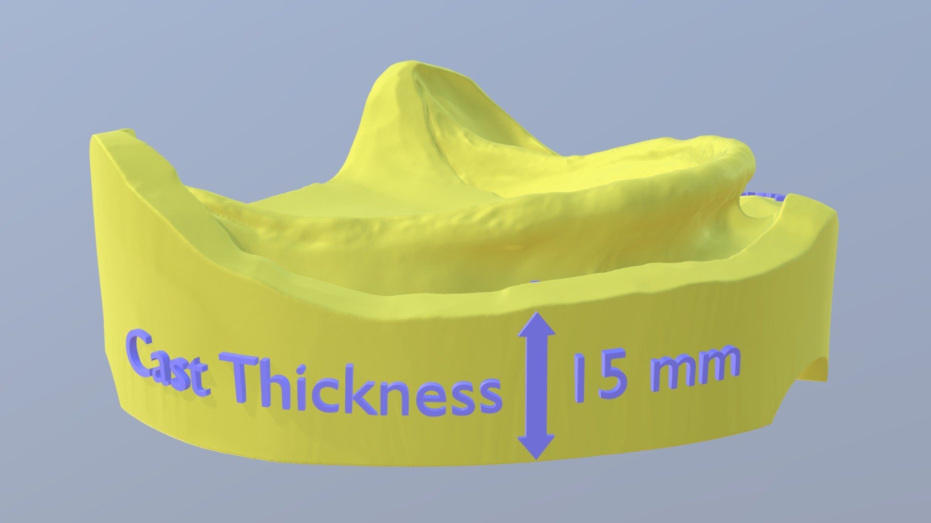 Mandibular (Lower) Cast for a Complete Denture - 3D model by ramiammoun ...