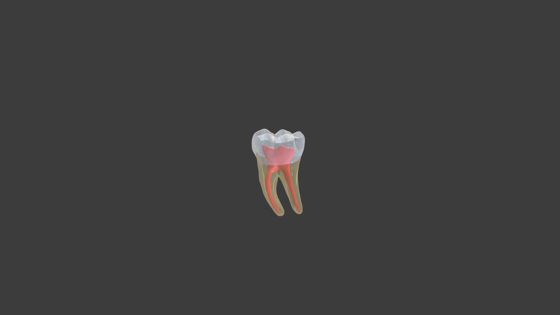 Mandibular 1st molar 4 canals - 3D model by Ahmed Mahrous ...