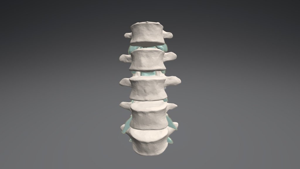 Medical Models - A 3D model collection by 3dradiologylab - Sketchfab
