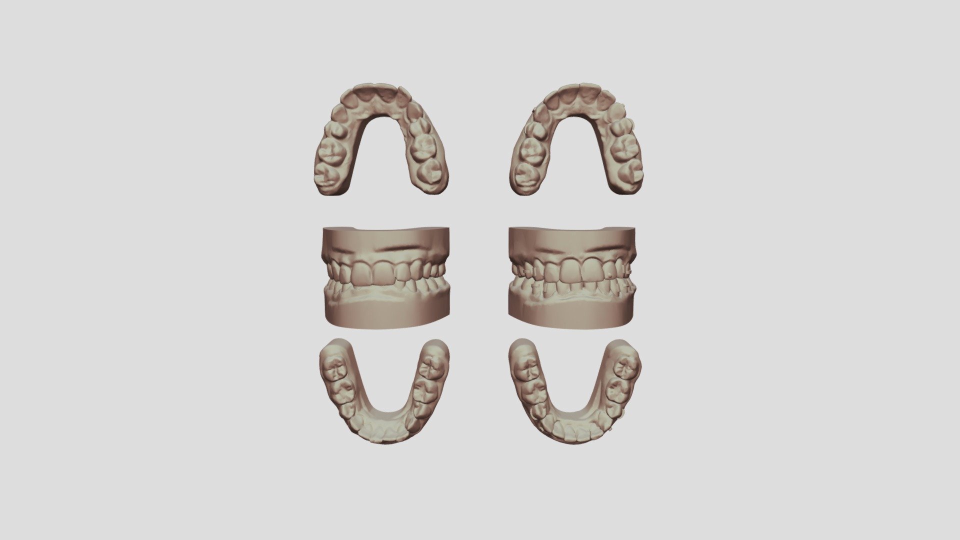 MO - 3D model by 001 (@uzegeortho) [1537235] - Sketchfab