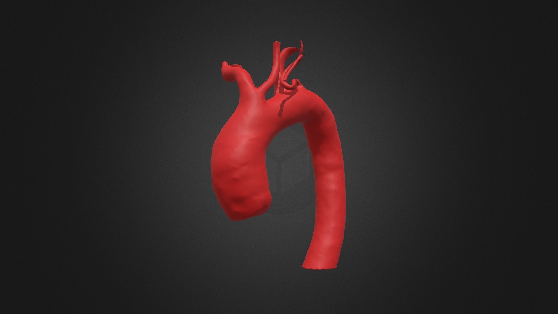 Left internal mammary artery arising from aorta - 3D model by ...