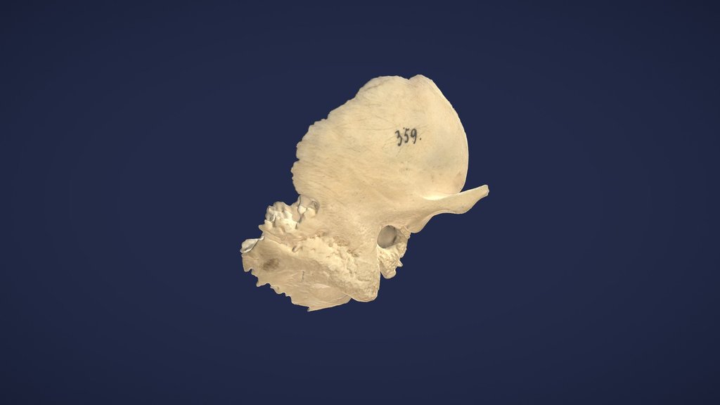 NF - A 3D model collection by Institute of Anatomy Rostock (@Alexander ...