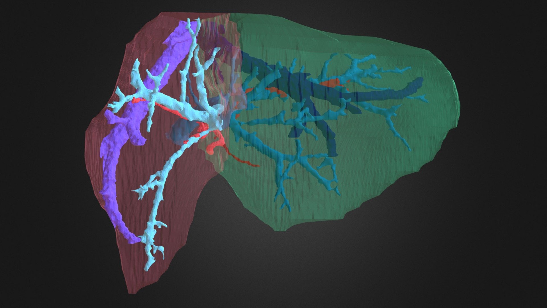 3graft left lobe - Download Free 3D model by chloroplast [15c37e3 ...