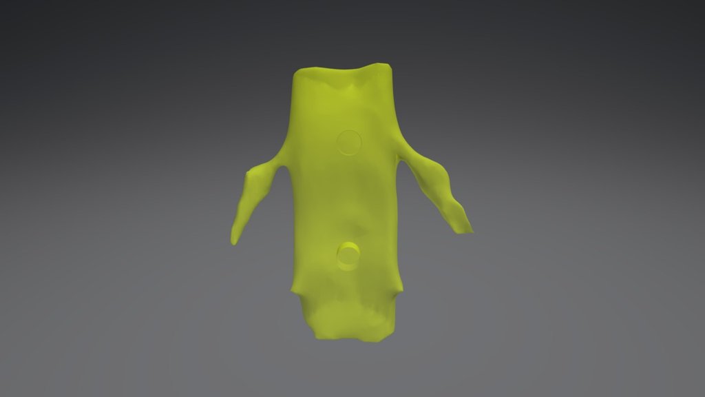 L3-4 Thecal Sac With Dowels - Download Free 3D model by Justin Cramer ...