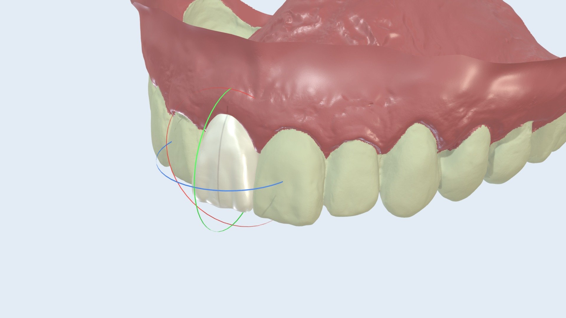 Mandibular test1 - 3D model by ghost899 [15ed9da] - Sketchfab