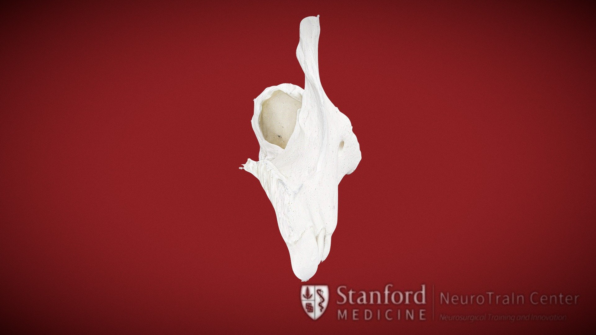 Maxillary Bone - 3D model by vv (@verav) [160fb88] - Sketchfab
