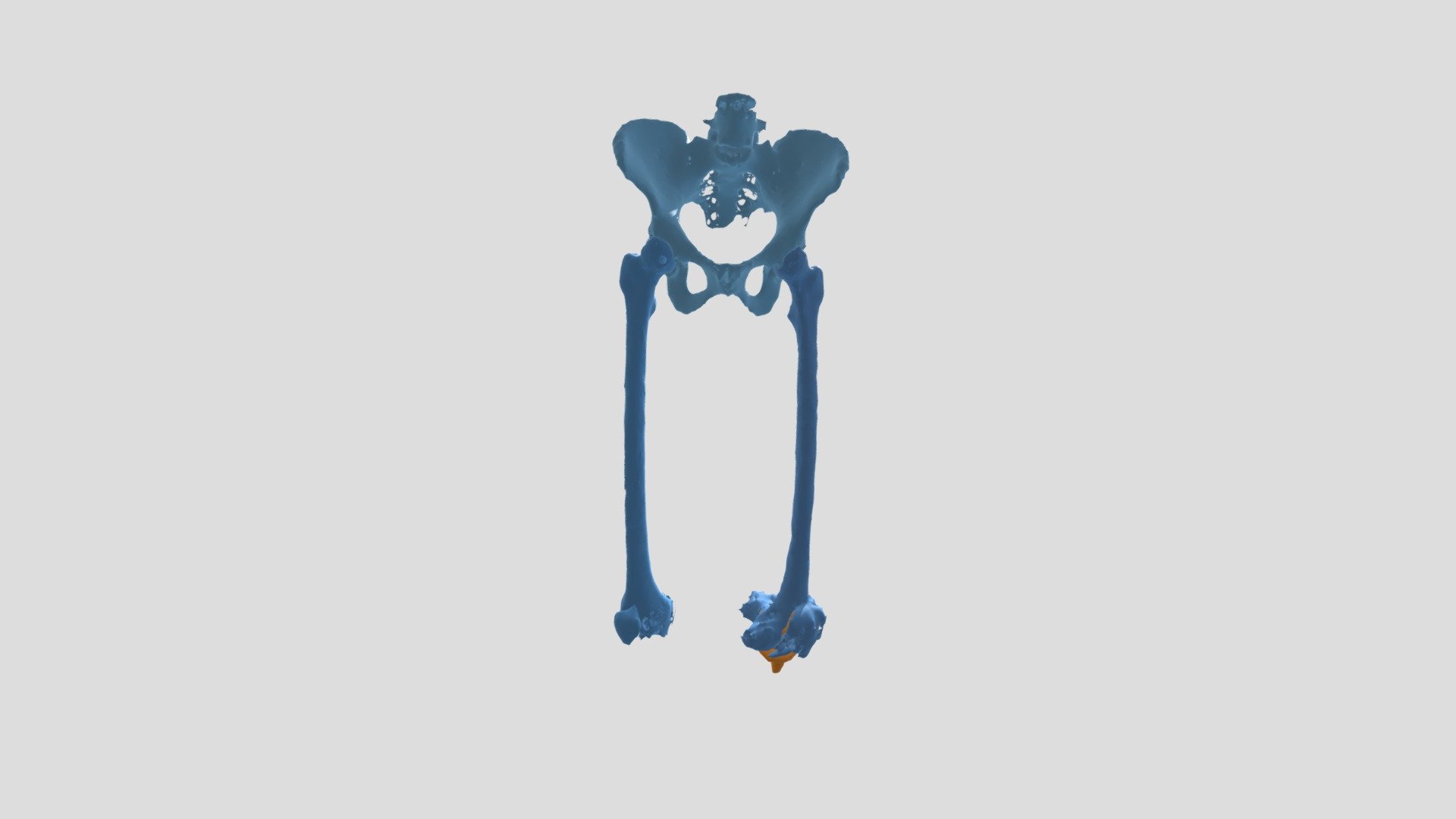 Femur Segmentation 3d Model By Shannon Sweeney [16115f7] Sketchfab