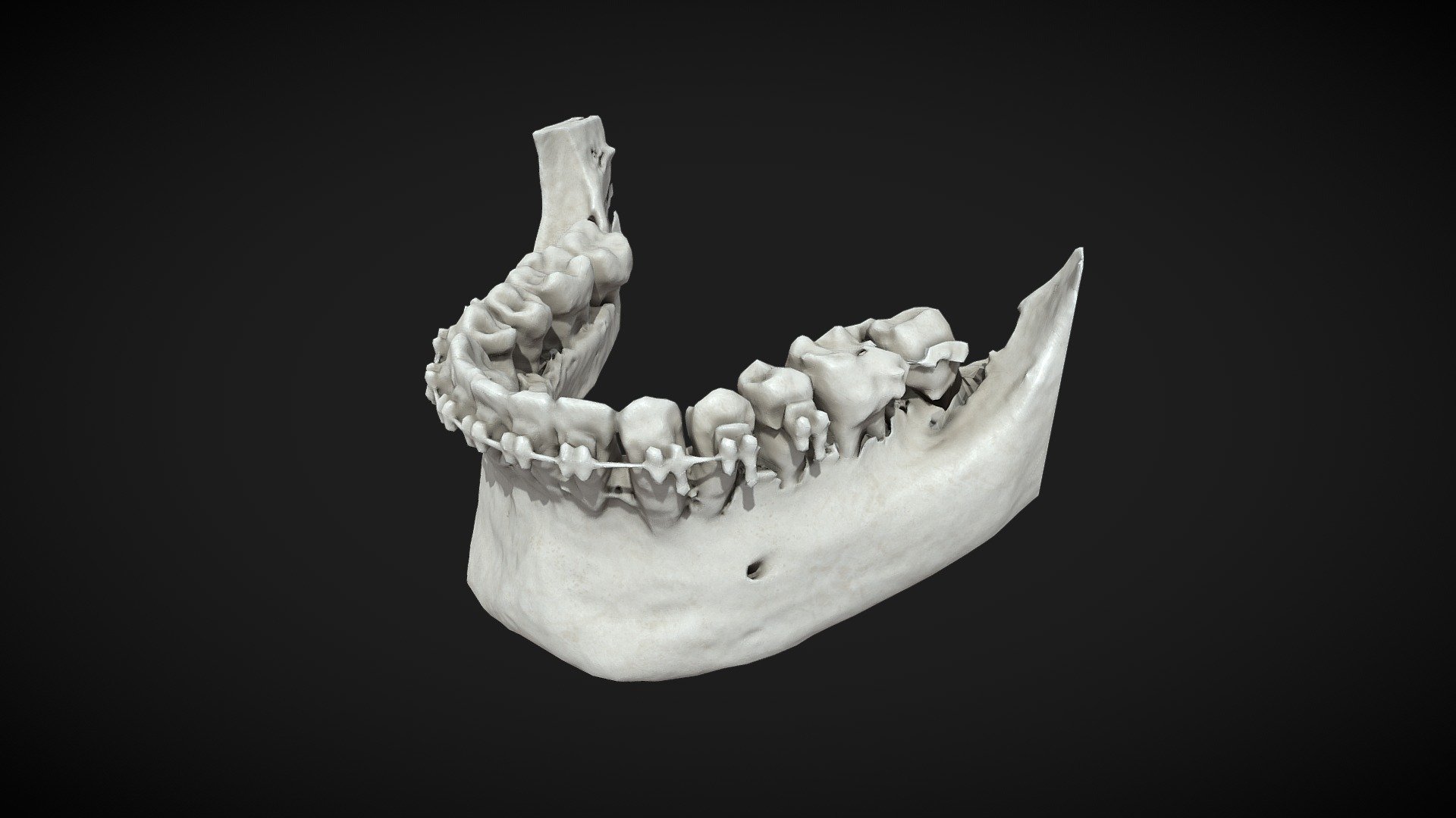 Mandible Web - 3D model by colcrea3d [16a470c] - Sketchfab