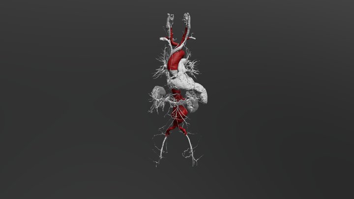 Aorta 3D models - Sketchfab