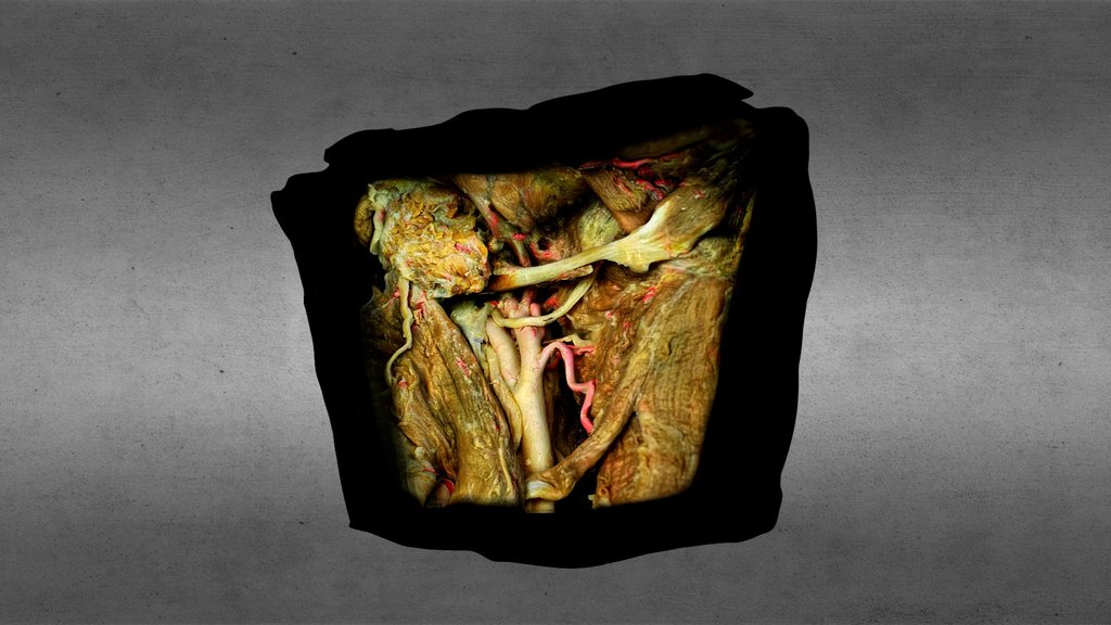 Smith-Robinson Approach Anatomy - A 3D model collection by vv (@verav ...