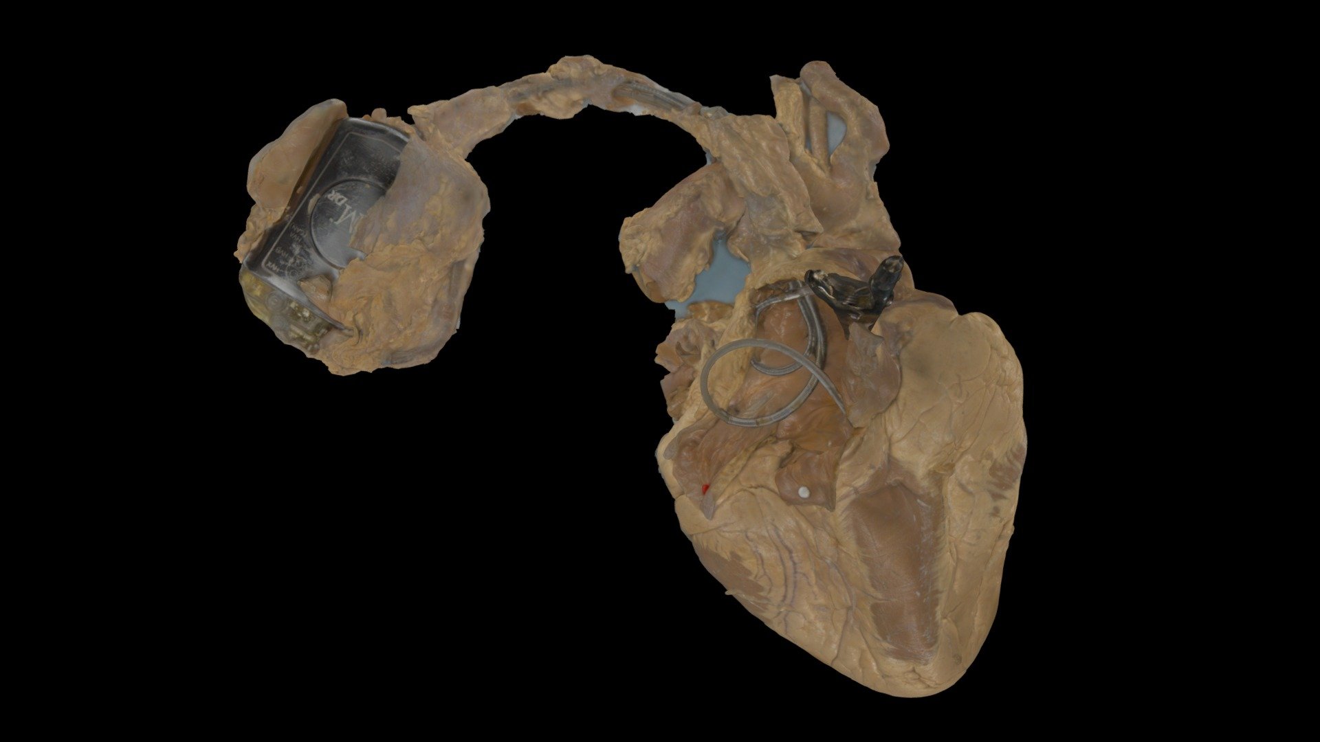 Human Heart with Defib Pocket - Download Free 3D model by ...