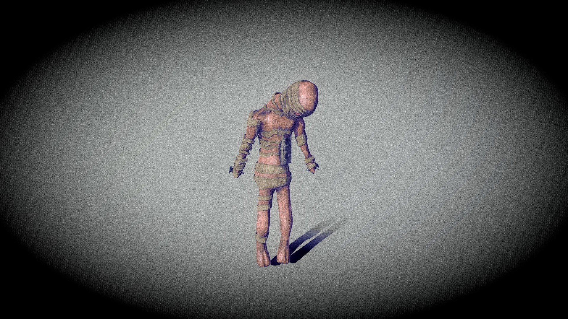 Patient "S" - Download Free 3D model by MakenzieBeggs [186544b] - Sketchfab
