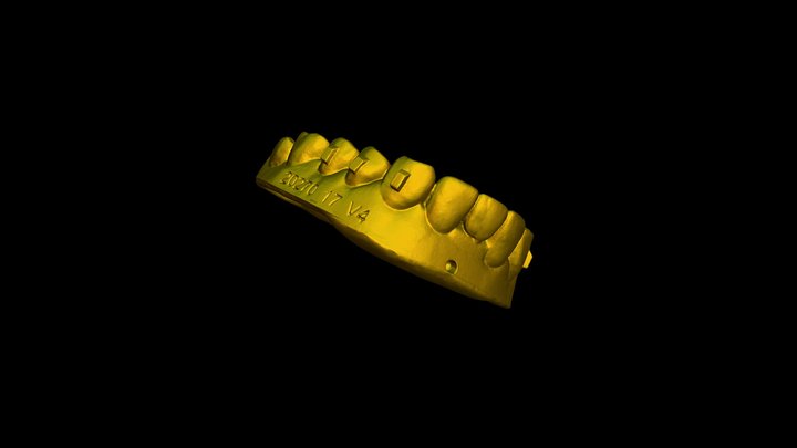 Denture 3D models - Sketchfab